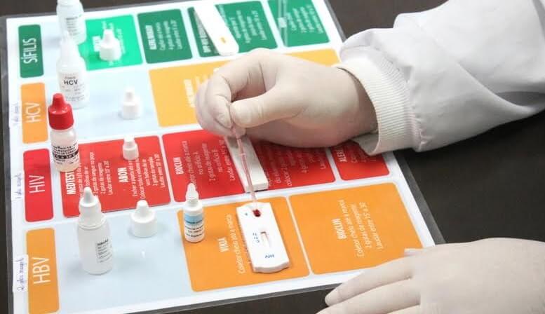 Unidades de saúde devem estimular testes rápidos de HIV/Aids, sífilis e ...